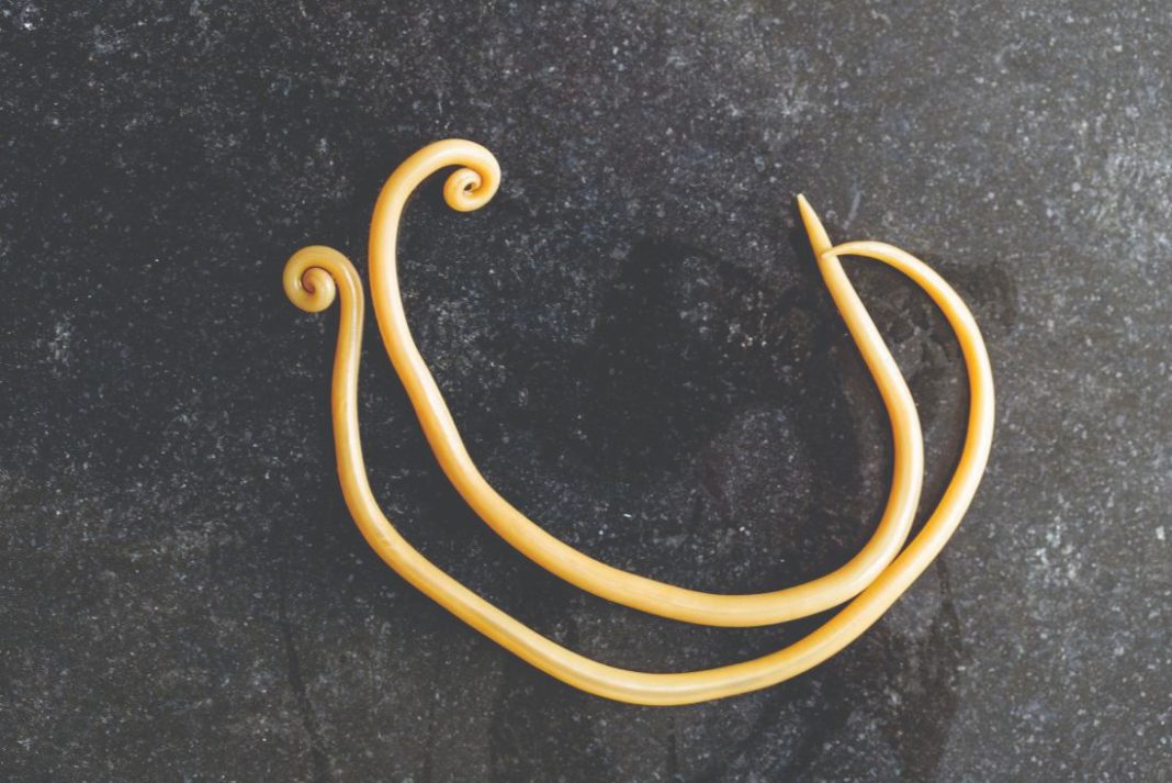 Crijevni nametnici- paraziti - Gospodarski list