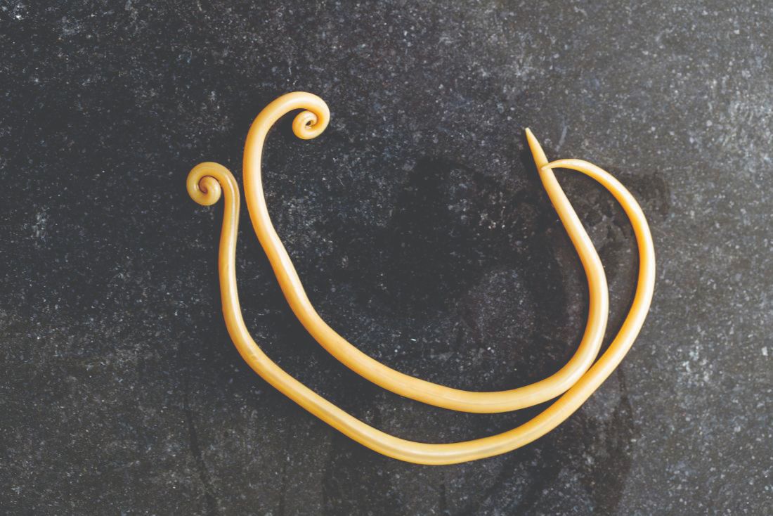 Crijevni nametnici- paraziti - Gospodarski list